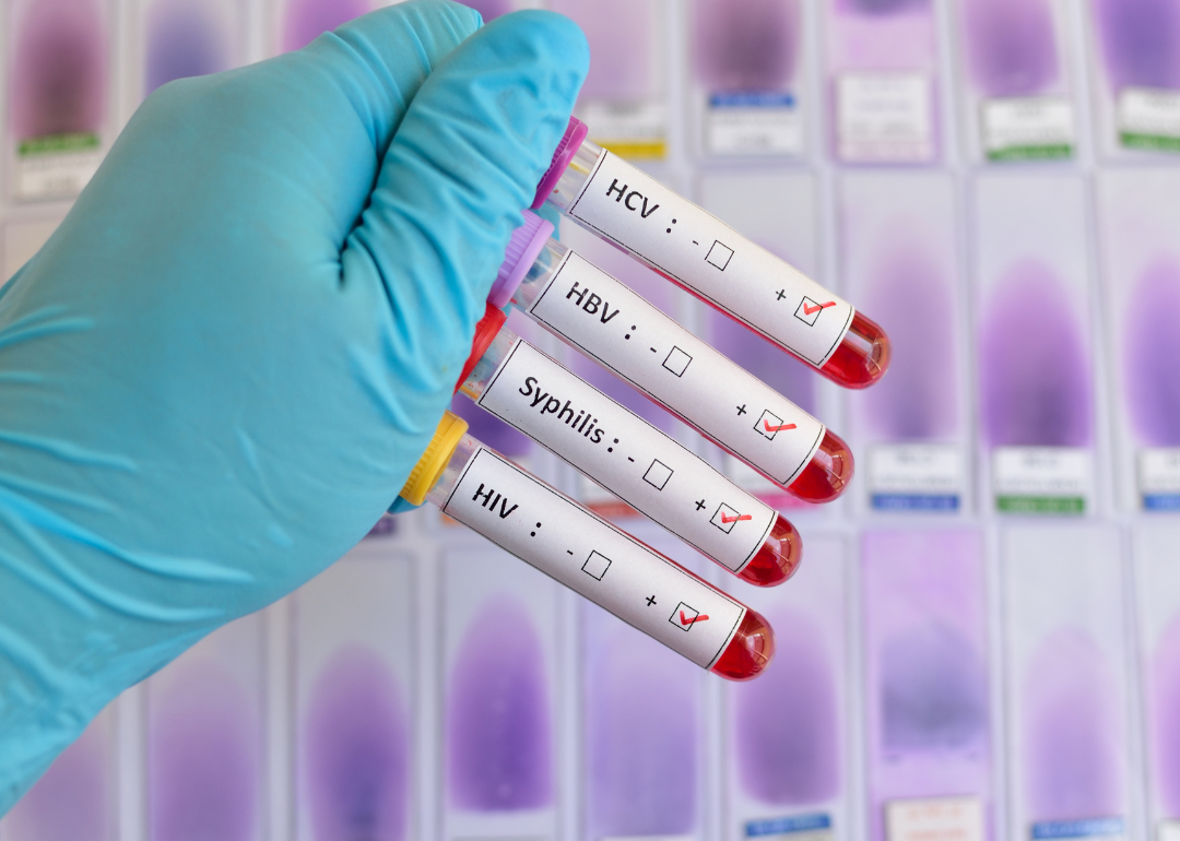 States With the Highest Incidence of STIs | Stacker
