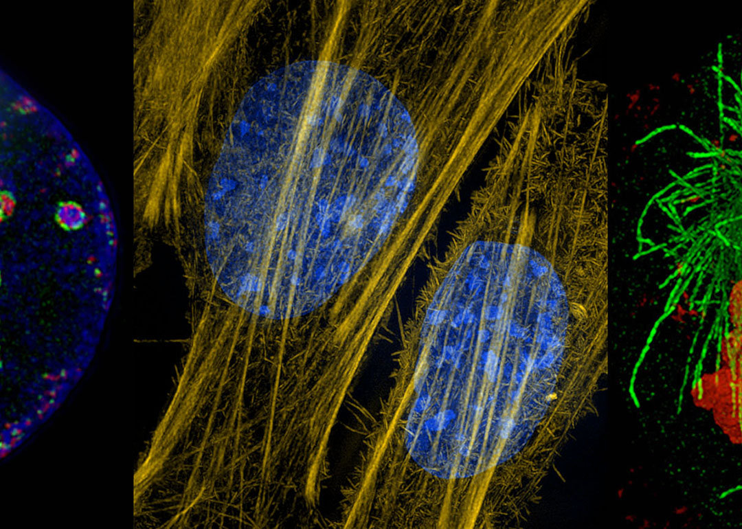Super-resolution microscopes showcase the inner lives of cells | Stacker