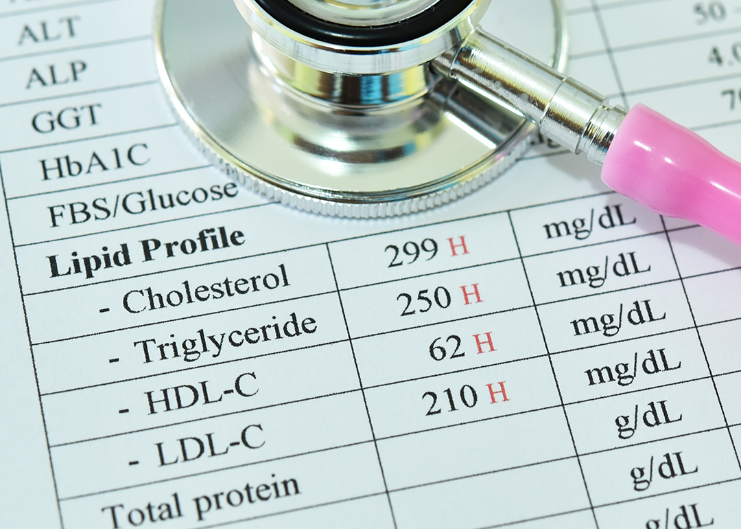 Common medications for high cholesterol | Stacker